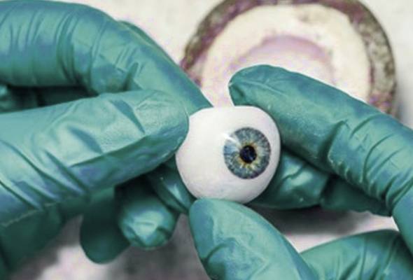 Prosthetic eye helps restore confidence | AWANI International