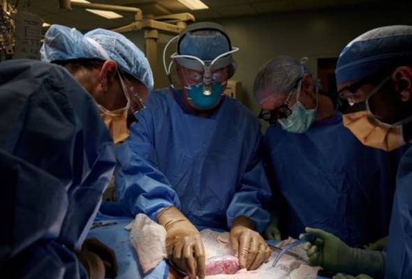 Pakar bedah AS berjaya lakukan pemindahan buah pinggang babi kepada ...