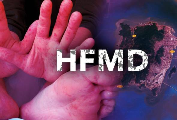 HFMD cases rise by 20-fold, Selangor still records highest number - Dr ...