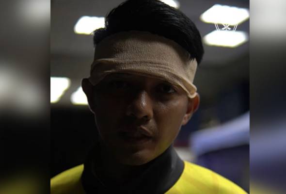 Izham tetap bersemangat walaupun terima jahitan di kepala | Astro Awani