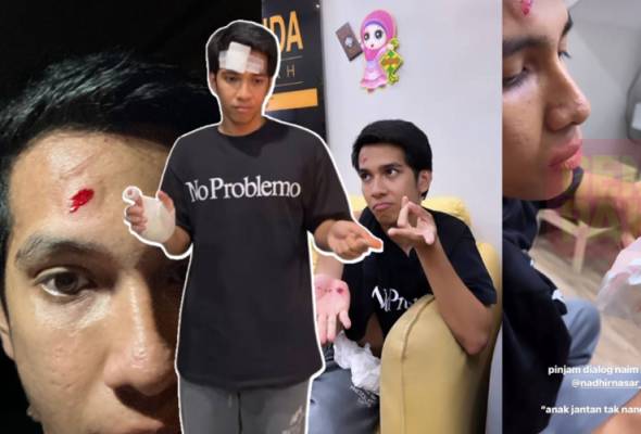 Naim Daniel cedera dahi, pecah kuku jari main mercun bola | Astro Awani