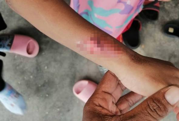 Bapa kandung, ibu tiri ditahan, disyaki dera kanak-kanak 6 tahun | Astro Awani