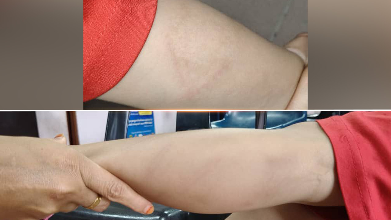 Polis tahan guru wanita bantu siasatan rotan pelajar sehingga lebam dan ...